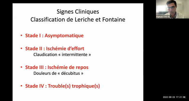 POD - UVSQ - Ue 2.8 S3 - Artériopathie Oblitérante De L'A…